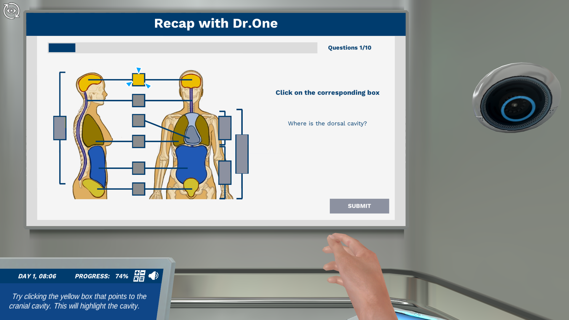 Body Structure and Organization: Help identify a potentially failing ...
