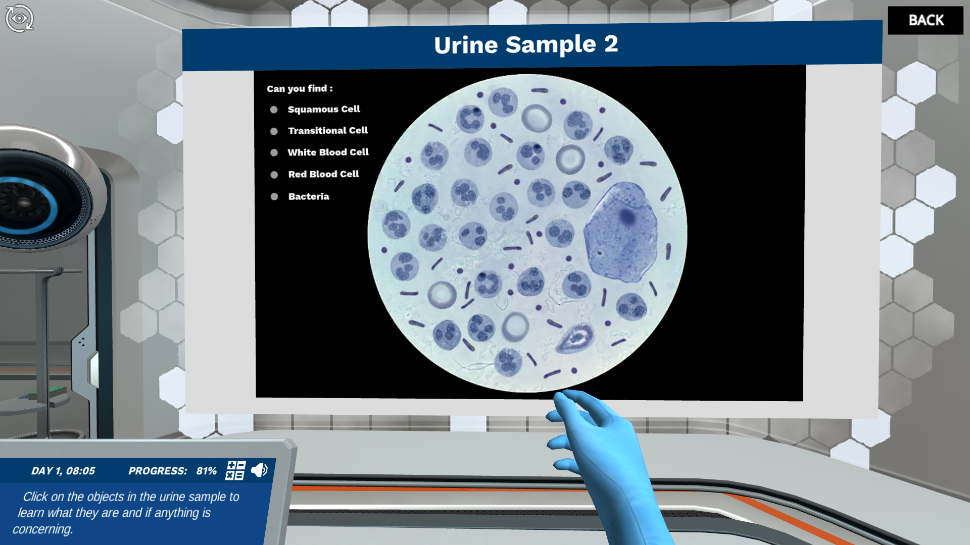 Urinalysis: Analyze urine to suggest a diagnosis | Labster Virtual Labs